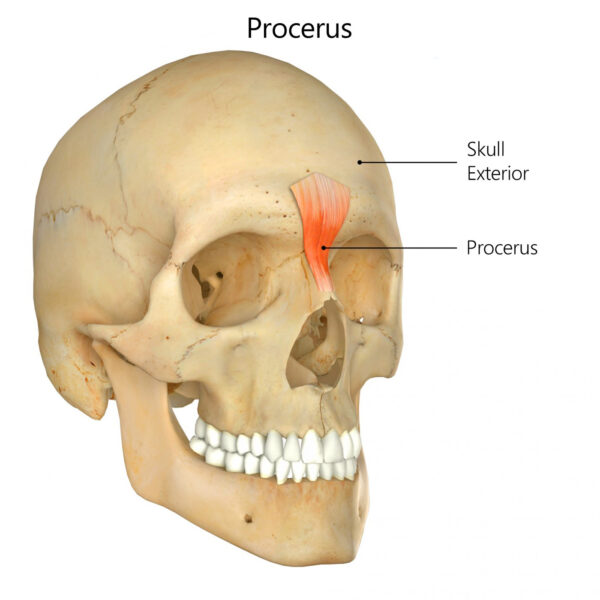 Procerus – ISO Metrik